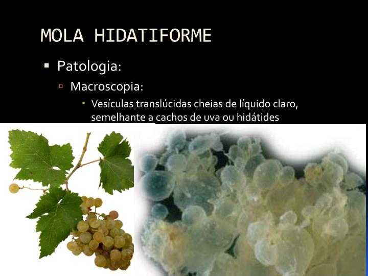 PPT - CASO CLÍNICO PowerPoint Presentation - ID:5637346