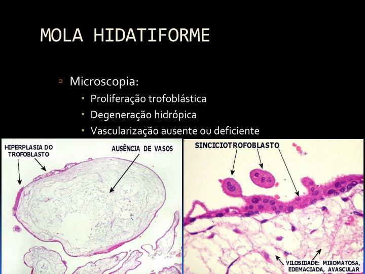 PPT - CASO CLÍNICO PowerPoint Presentation - ID:5637346