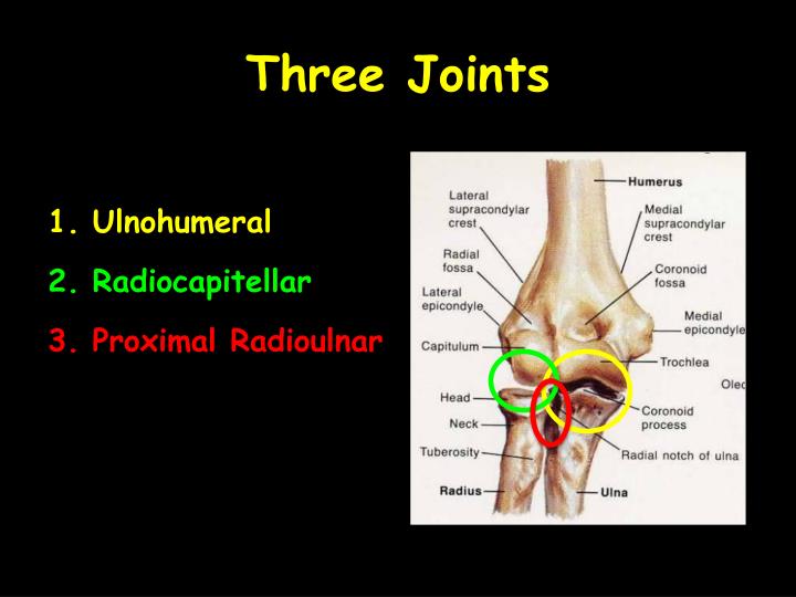 PPT - Surgical Management of Intra-Articular Distal Humerus Fractures ...