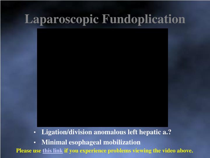 PPT - Laparoscopic Nissen Fundoplication and Gastrostomy – How I Do It ...