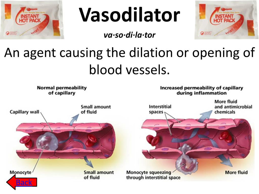 PPT - Hematoma he·ma·to·ma / (haematˈtō-mə) PowerPoint Presentation ...