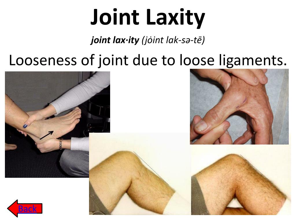 PPT - Hematoma he·ma·to·ma / (haematˈtō-mə) PowerPoint Presentation ...