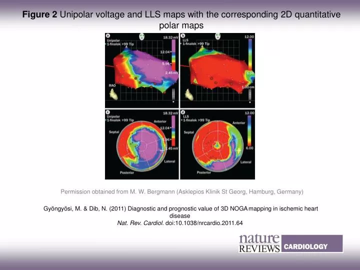 PPT - Figure 2 Unipolar voltage and LLS maps with the corresponding 2D ...