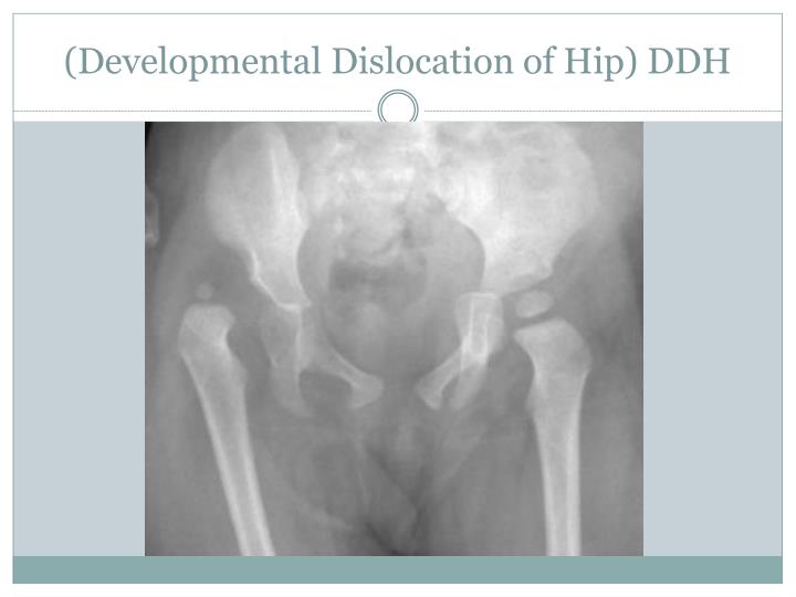 PPT - Introduction to Orthopaedics PowerPoint Presentation - ID:5646286