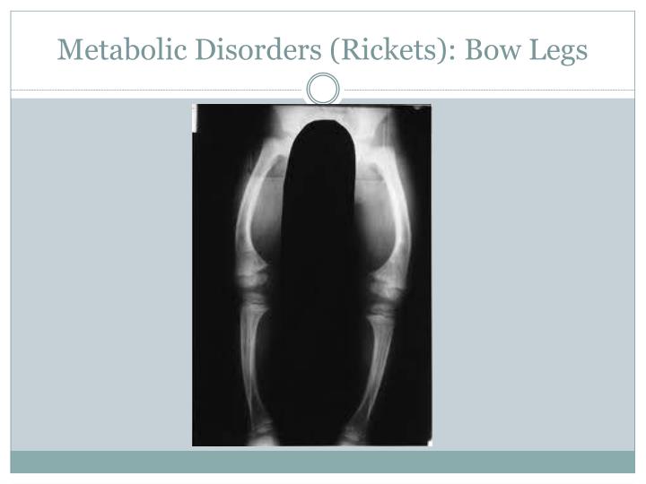 PPT - Introduction to Orthopaedics PowerPoint Presentation - ID:5646286