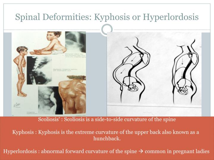 PPT - Introduction to Orthopaedics PowerPoint Presentation - ID:5646286