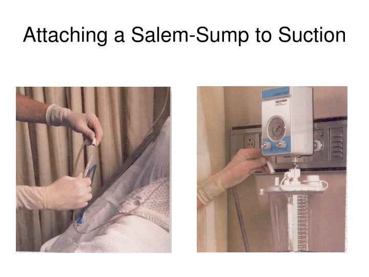 PPT - Nasogastric Tubes Lab I Part II PowerPoint Presentation - ID:5646783