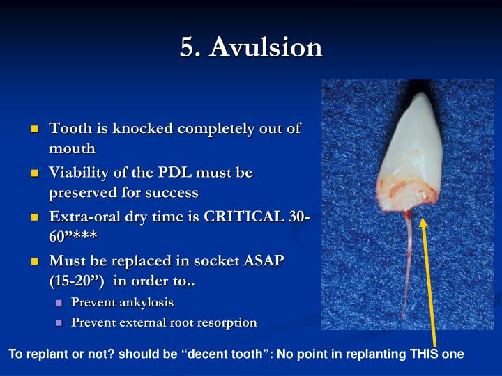 PPT - Traumatic Injuries, Cracked Teeth and vertical root fractures ...