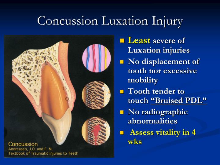 PPT - Traumatic Injuries, Cracked Teeth and vertical root fractures ...