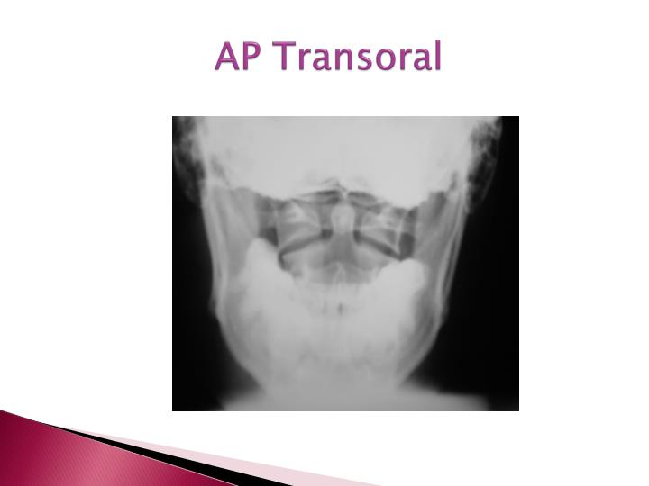 PPT - Coluna Vertebral PowerPoint Presentation - ID:5649671