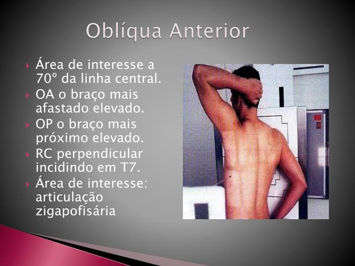 PPT - Coluna Vertebral PowerPoint Presentation - ID:5649671