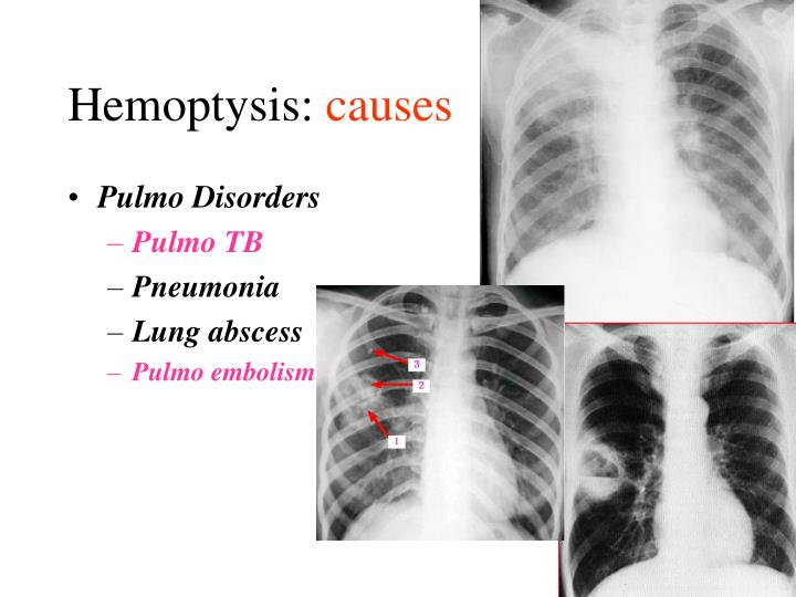 PPT - Respiratory Symptoms PowerPoint Presentation - ID:5650763