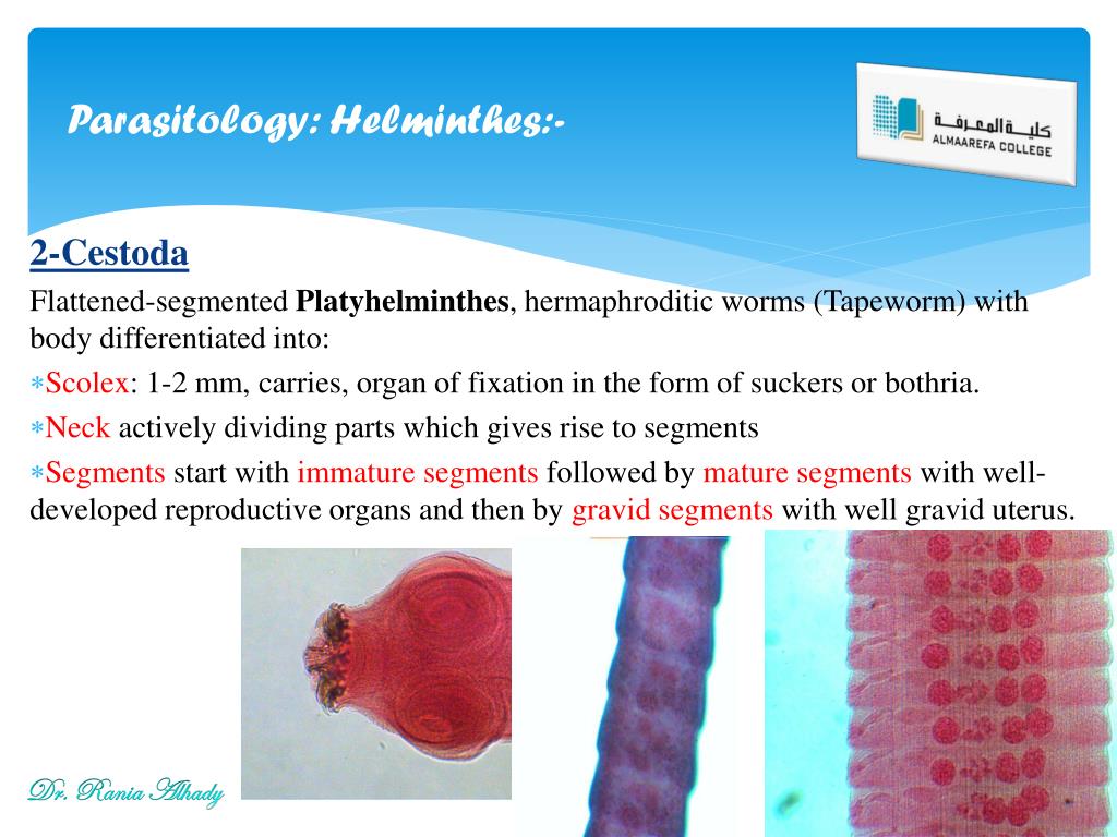 PPT - Parasitology: (Protozoa and Helminthes) PowerPoint Presentation ...