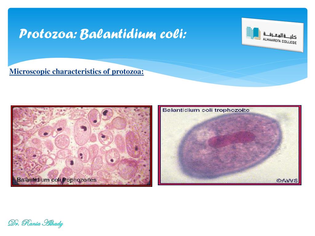 PPT - Parasitology: (Protozoa and Helminthes) PowerPoint Presentation ...