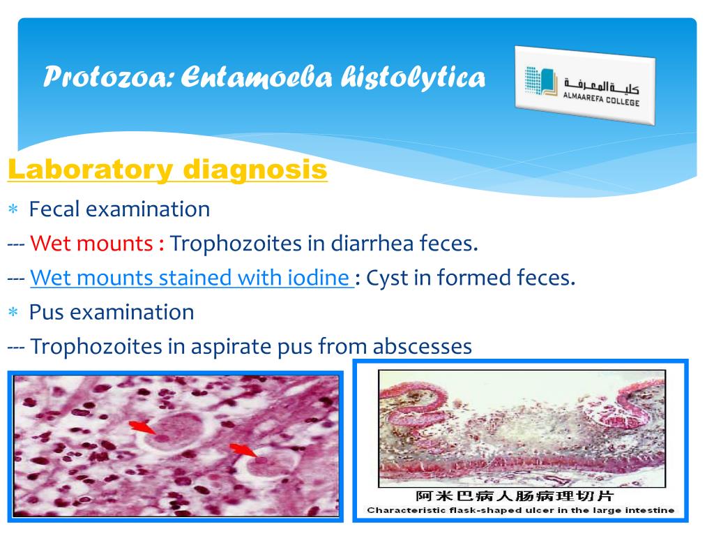 PPT - Parasitology: (Protozoa and Helminthes) PowerPoint Presentation ...
