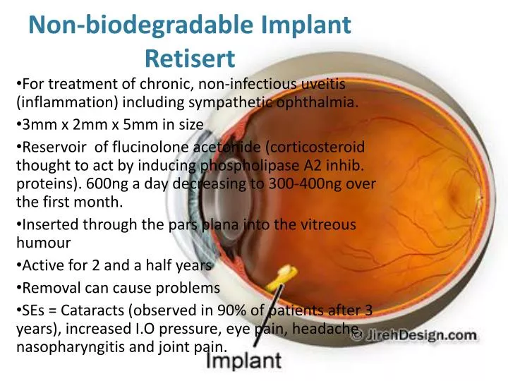 PPT - Non-biodegradable Implant Retisert PowerPoint Presentation, free ...