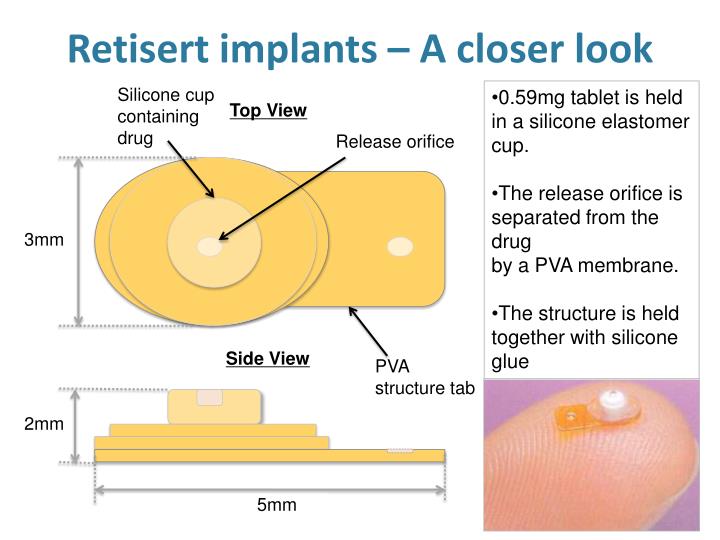 PPT - Non-biodegradable Implant Retisert PowerPoint Presentation - ID ...