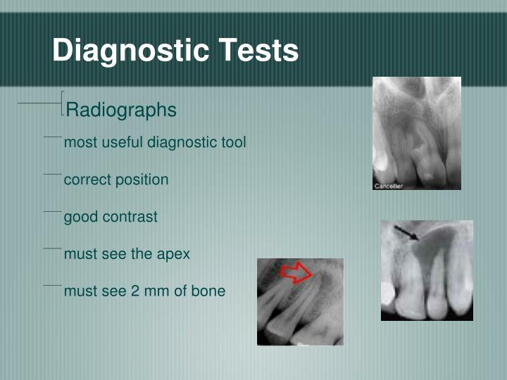 PPT - Chapter 24 Endodontics PowerPoint Presentation - ID:5652626