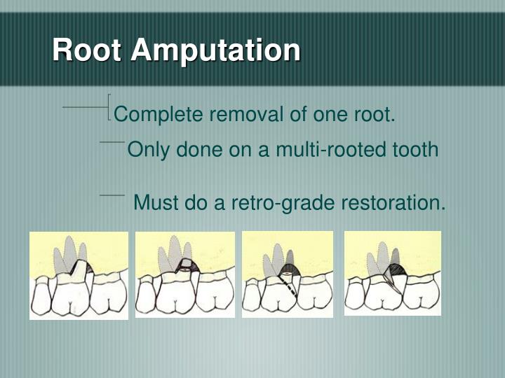 PPT - Chapter 24 Endodontics PowerPoint Presentation - ID:5652626