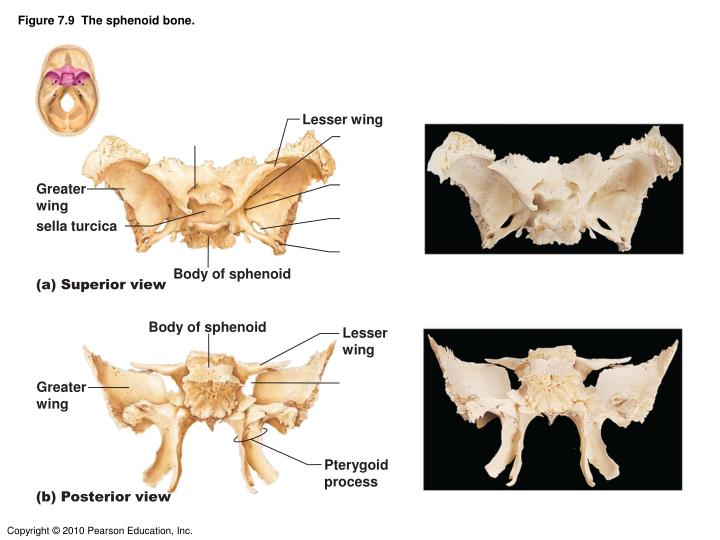 PPT - Figure 7.1 The human skeleton. PowerPoint Presentation - ID:5653216