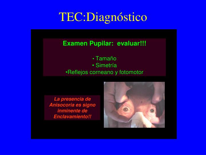 PPT - TRAUMATISMO ENCÉFALO CRANEAL PowerPoint Presentation - ID:5656384