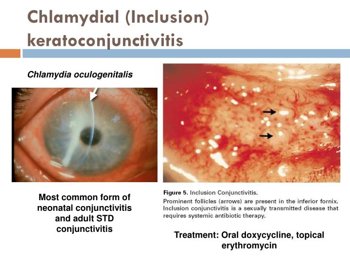 PPT - Red Eye PowerPoint Presentation - ID:5658491
