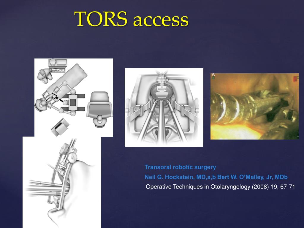 PPT - Oral Cancer Early diagnostic and Treatment PowerPoint ...