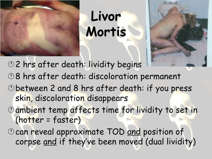 PPT - Death: Meaning, Manner, Mechanism, Cause, Time PowerPoint ...