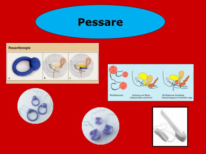 PPT - Der Beckenboden – Die weibliche Mitte PowerPoint Presentation ...