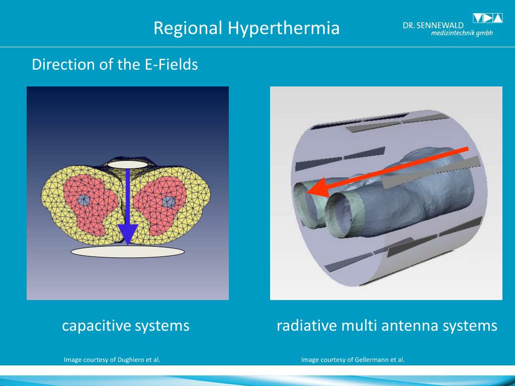 PPT - MR Image Guided Hyperthermia Gerhard Sennewald PhD, Munich ...