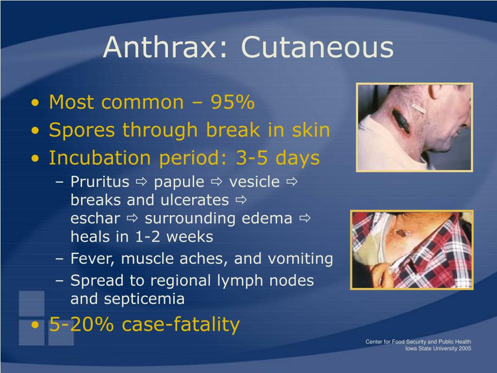 PPT - Zoonotic Diseases: Connections between Animal and Human Health ...