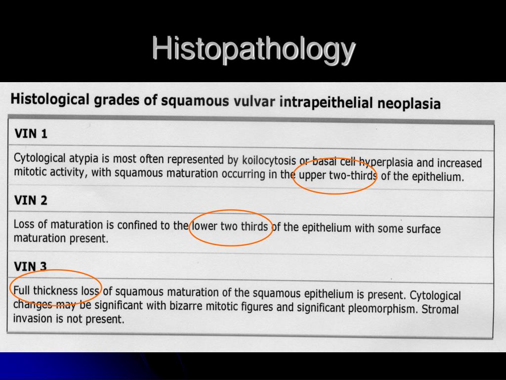 PPT - Pre-cancer and malignant disease of vulva PowerPoint Presentation ...
