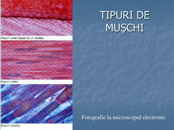 PPT - SISTEMUL MUSCULAR PowerPoint Presentation - ID:5667941
