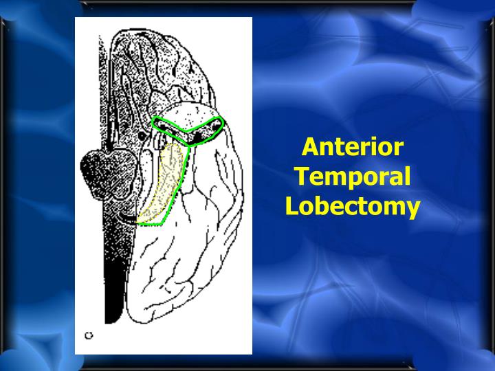 PPT - Neuropsychology of Epilepsy PowerPoint Presentation - ID:5668743
