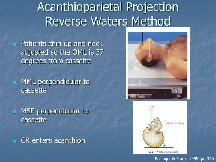 PPT - Radiography of the Orbits PowerPoint Presentation - ID:5669687