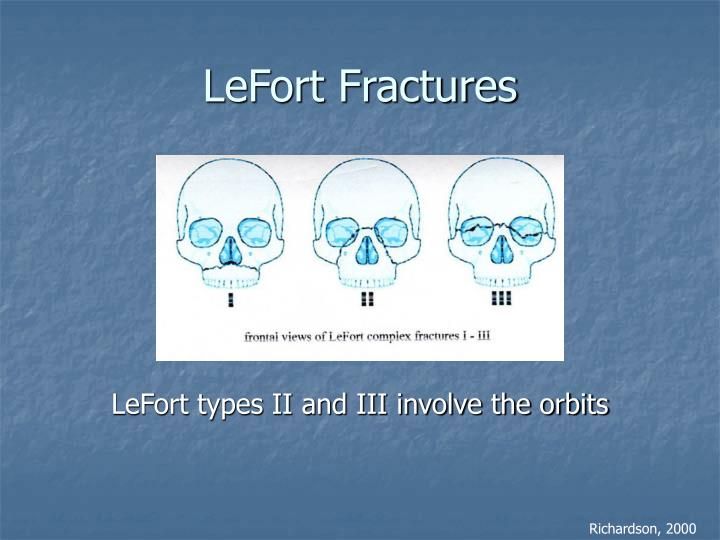 PPT - Radiography of the Orbits PowerPoint Presentation - ID:5669687