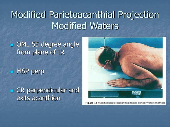 PPT - Radiography of the Orbits PowerPoint Presentation - ID:5669687