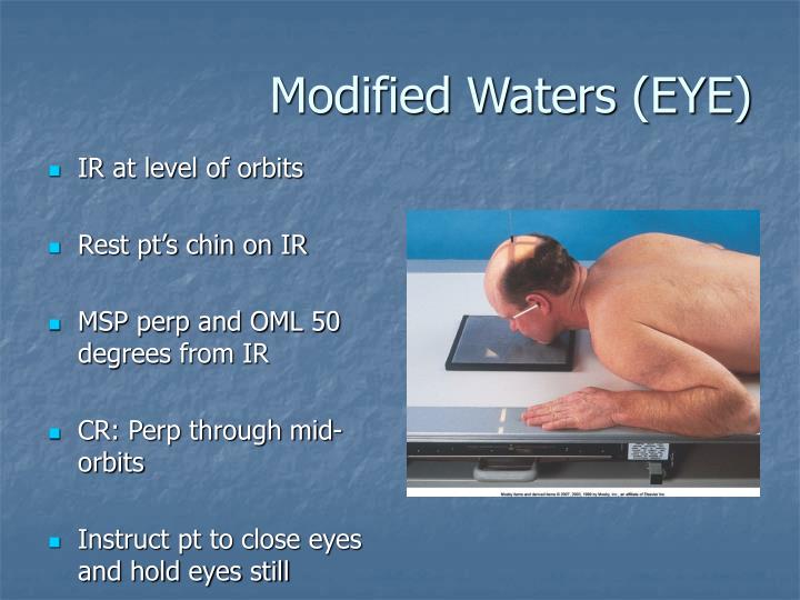 PPT - Radiography of the Orbits PowerPoint Presentation - ID:5669687