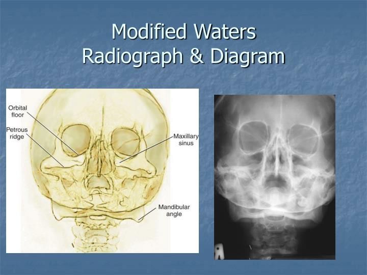PPT - Radiography of the Orbits PowerPoint Presentation - ID:5669687