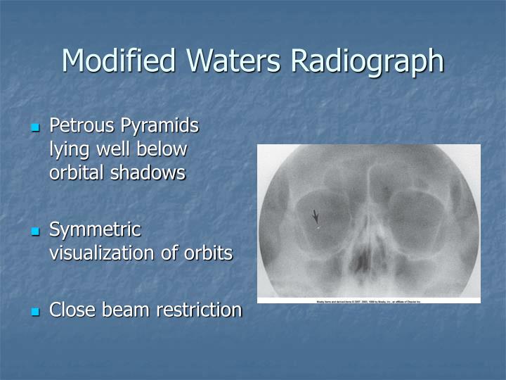 PPT - Radiography of the Orbits PowerPoint Presentation - ID:5669687
