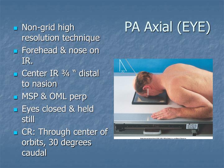 PPT - Radiography of the Orbits PowerPoint Presentation - ID:5669687