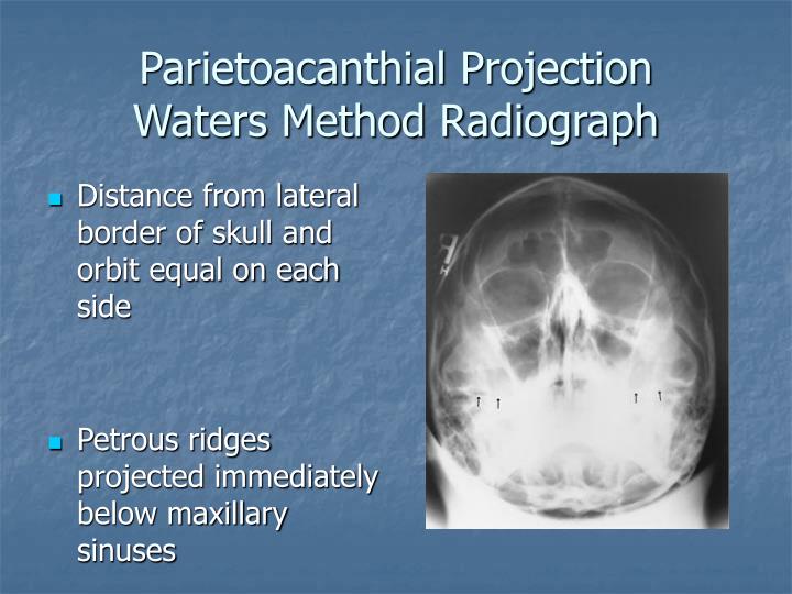 PPT - Radiography of the Orbits PowerPoint Presentation - ID:5669687