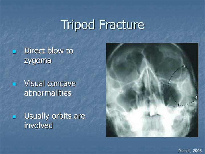 PPT - Radiography of the Orbits PowerPoint Presentation - ID:5669687