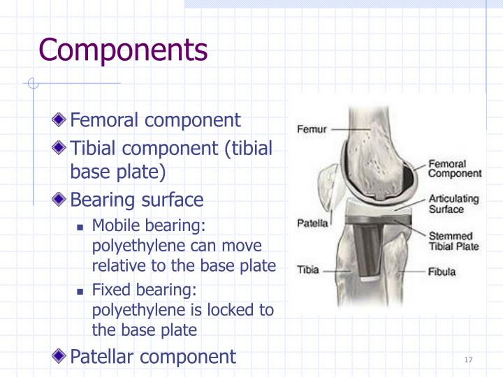 PPT - TOTAL KNEE ARTHROPLASTY (TKA) Total Knee Replacement (TKR ...