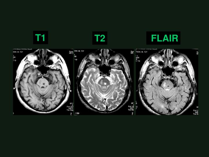 PPT - BRAIN IMAGING CT & MRI Mamdouh Mahfouz MD Professor of Radiology ...