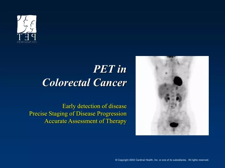 PPT - Colorectal Cancer PowerPoint Presentation, free download - ID:5671761