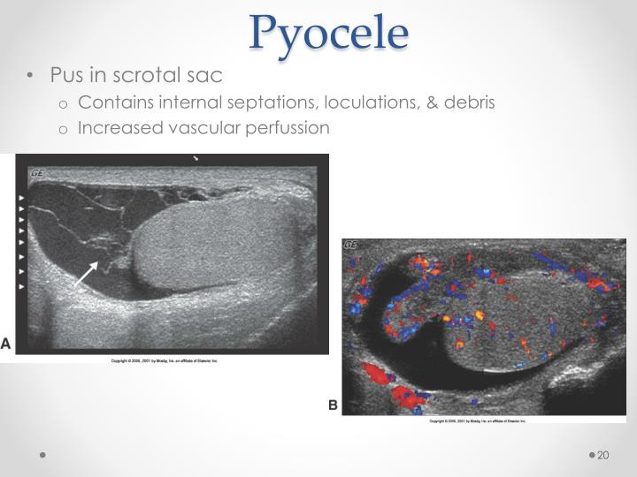 PPT - Scrotal Ultrasound PowerPoint Presentation - ID:5671926