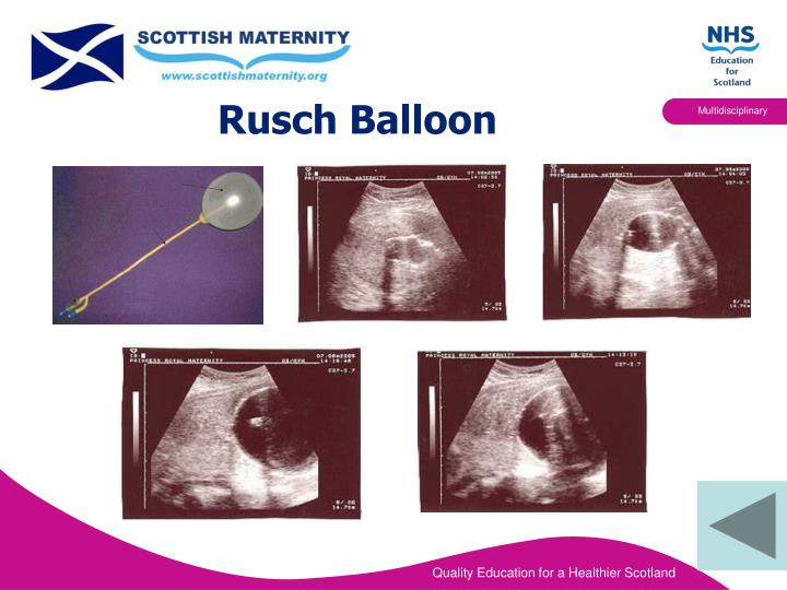 PPT - Obstetric Haemorrhage PowerPoint Presentation - ID:5672984