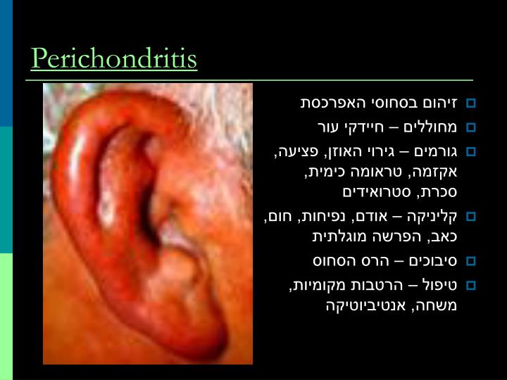 PPT - אוזן חיצונית External ear PowerPoint Presentation - ID:5673040