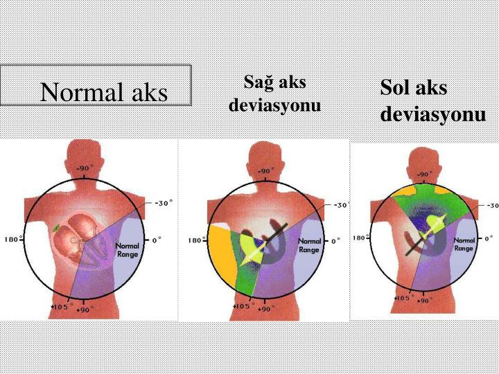 PPT - EKG PowerPoint Presentation - ID:5673221